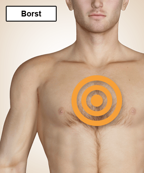 Pijn op de borst | Hier Heb Ik Pijn